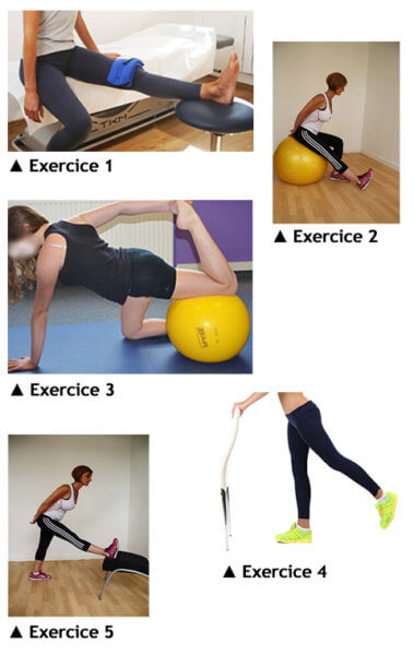 Arthrose du genou, l’auto rééducation | IRBMS