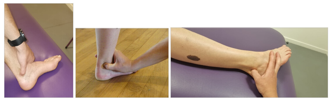 Conflit postérieur de cheville chez le danseur | IRBMS