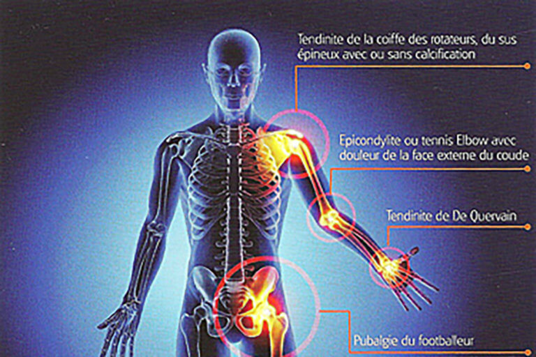 IRBMS, Médecine du Sport et Sport Santé